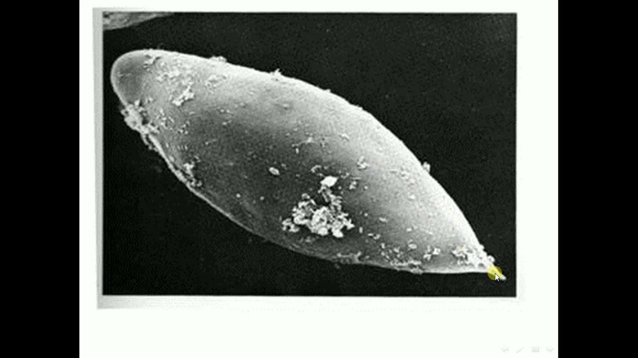 Parasite of urinary system - YouTube