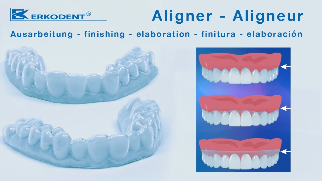 Aligner finitura - YouTube