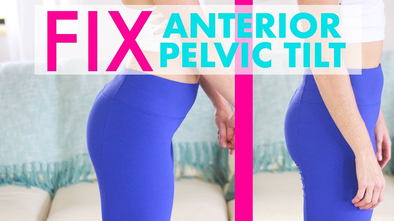 Fix Anterior Pelvic Tilt With 5 Stretches Youtube
