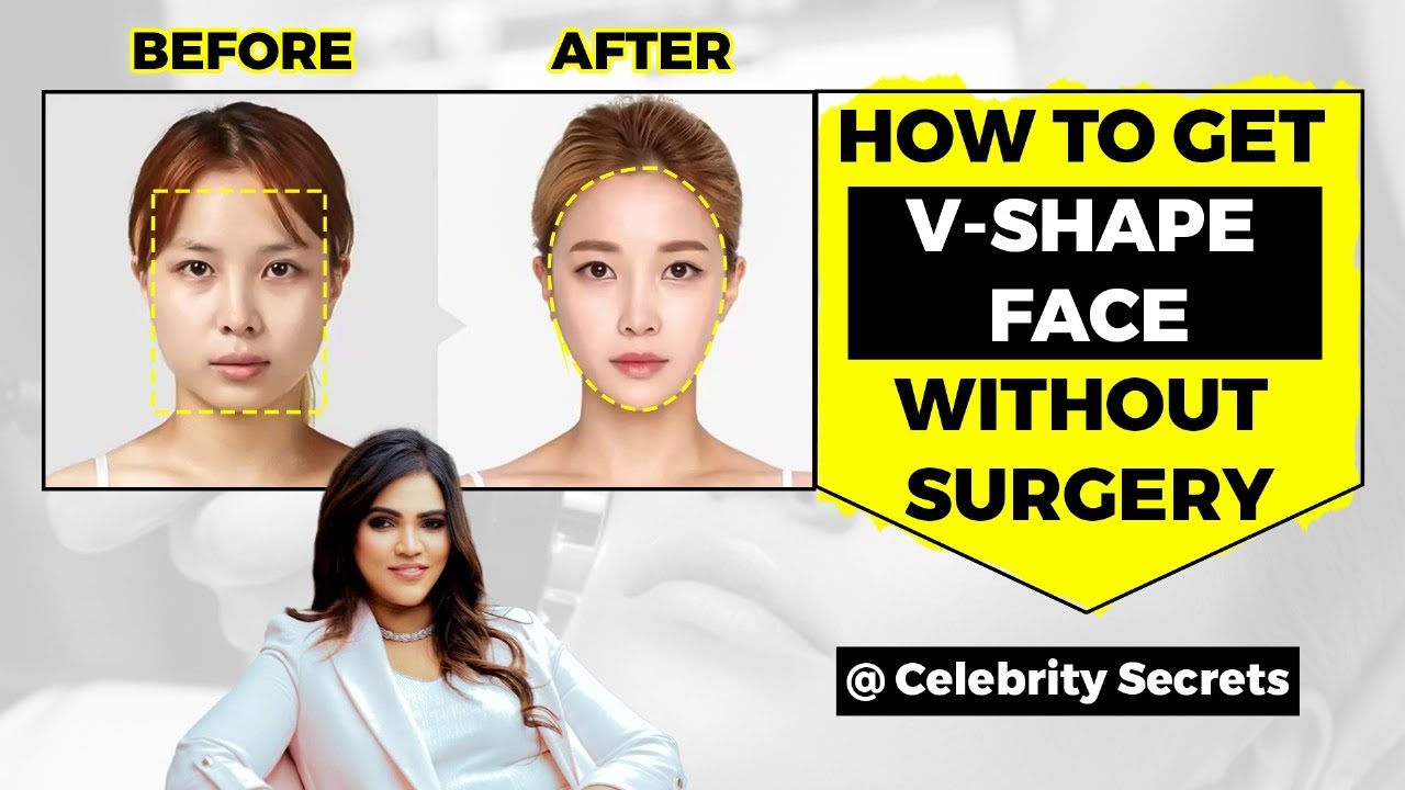 Get a V-Shape Face Without Surgery | Transform Your Face Shape ...