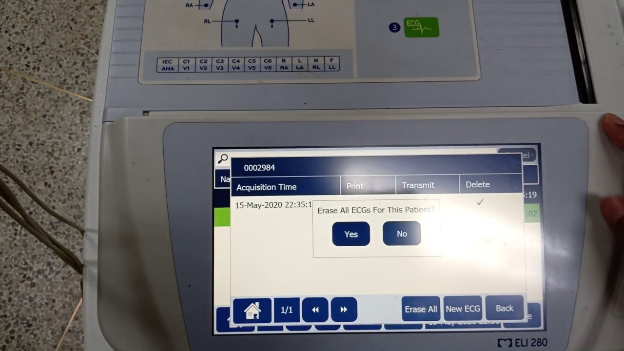 วิธีการใช้EKG 12lead #Mortara ELI 280 เข้าระบบ Himpro - YouTube