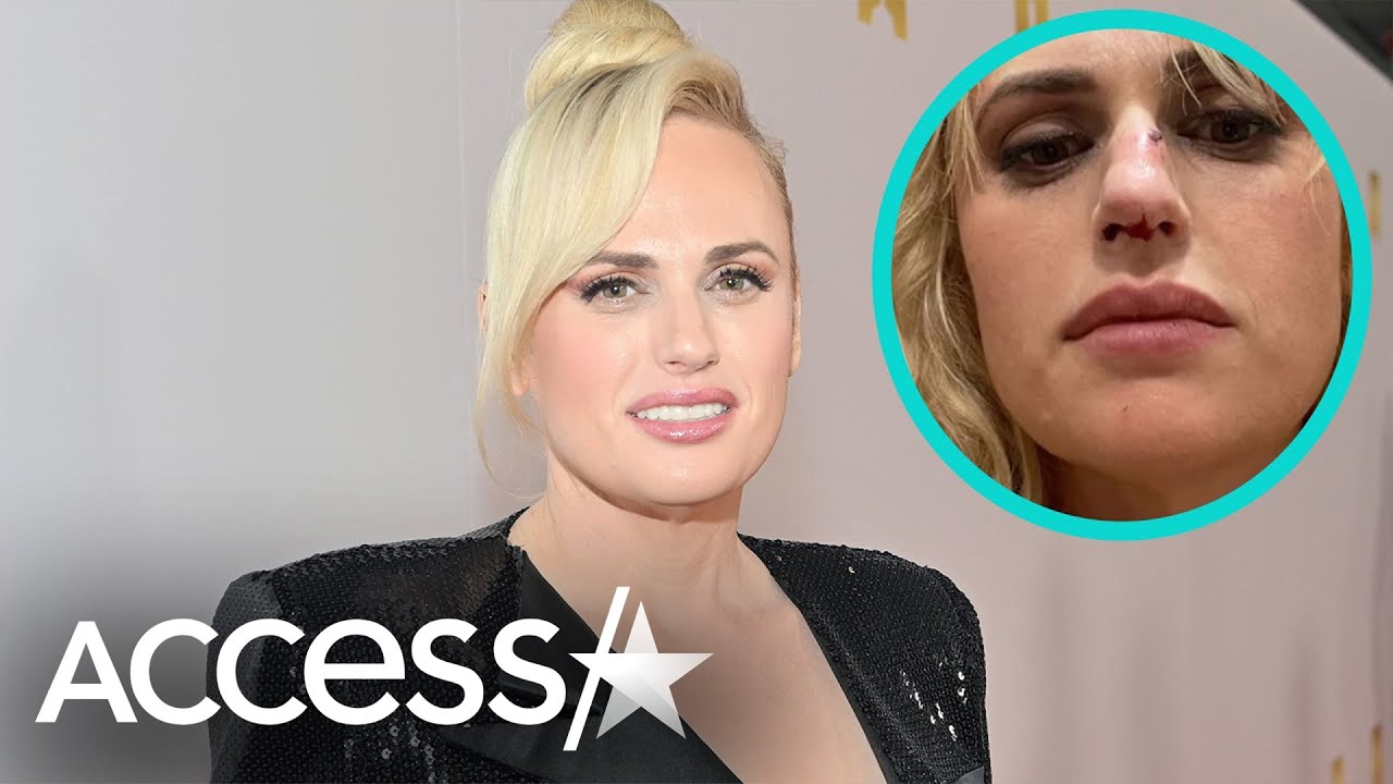 Rebel Wilson Rushed To Hospital Following Stunt Accident - YouTube