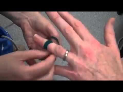 how to easily remove a ring from a swollen finger - YouTube