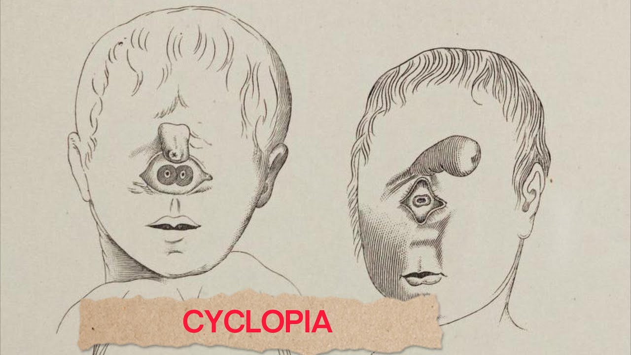 Unveiling Cyclopia: The Reality Behind the Myth - YouTube
