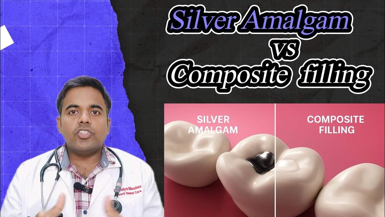 Silver Amalgam vs Composite Filling | Best Dental Filling Option ...