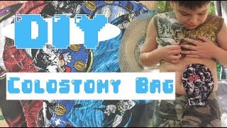 !Colostomy Bag Cover! | DIY