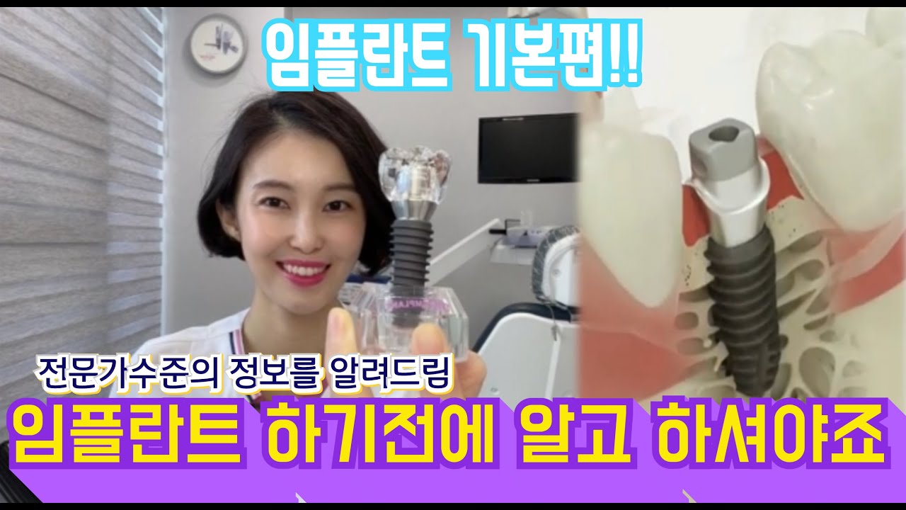 임플란트 하기전에 알고 하셔야죠 임플란트정보 Youtube