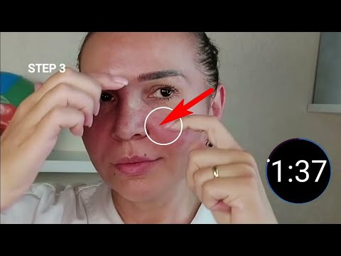 4 powerful techniques for NASOLABIAL FOLDS | BONE RESORPTION