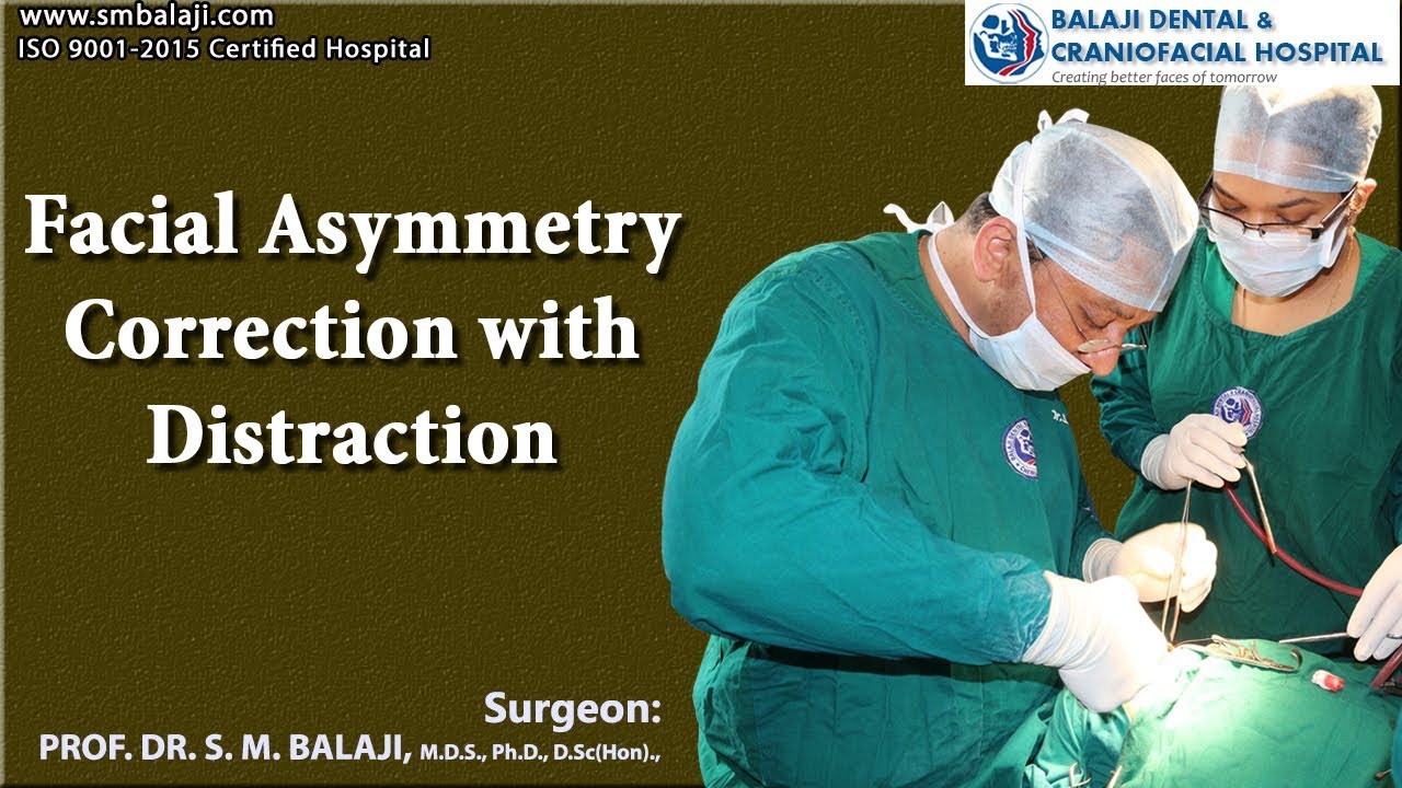 Facial Asymmetry Correction with Distraction - YouTube
