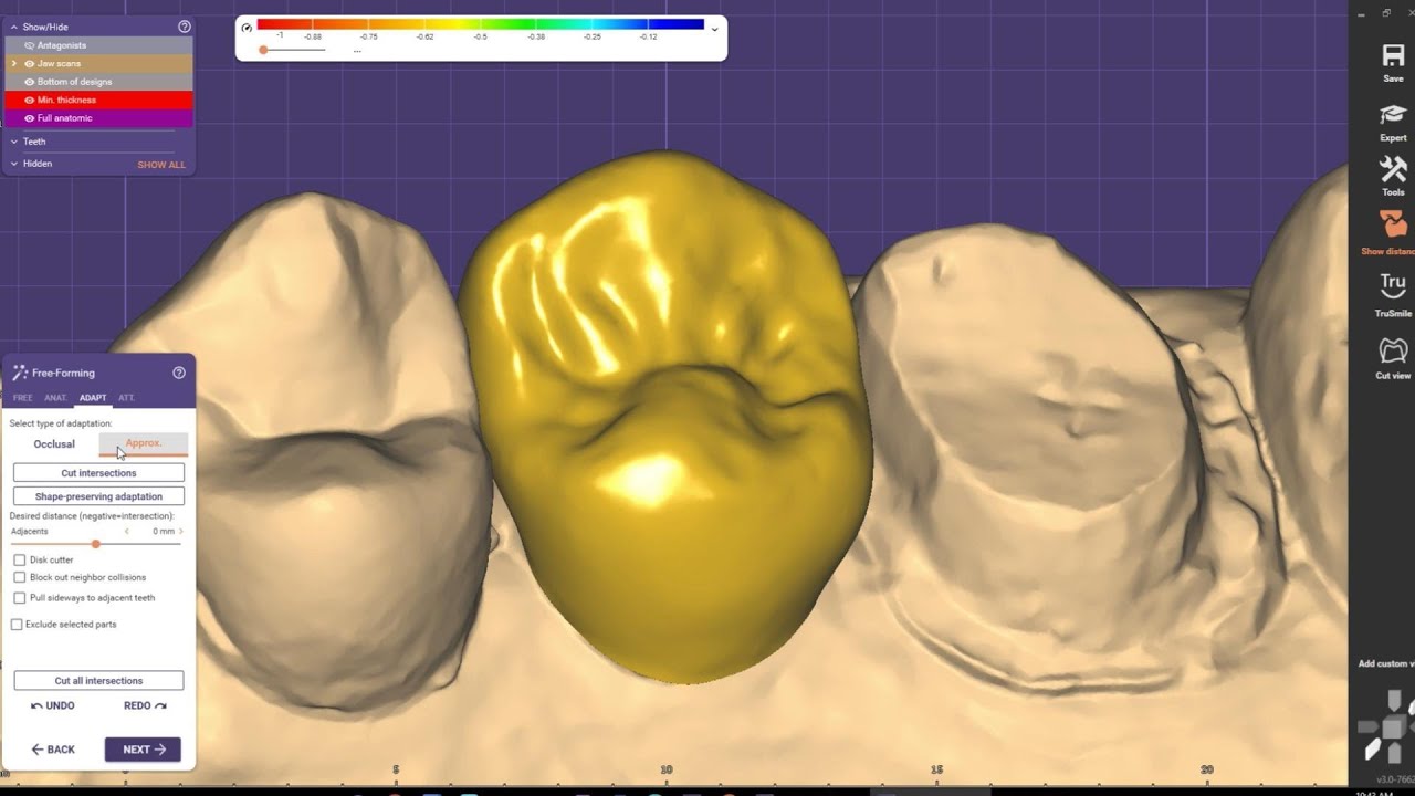 How to create a single crown in (ExoCad), Part 1. (kurdish language ...