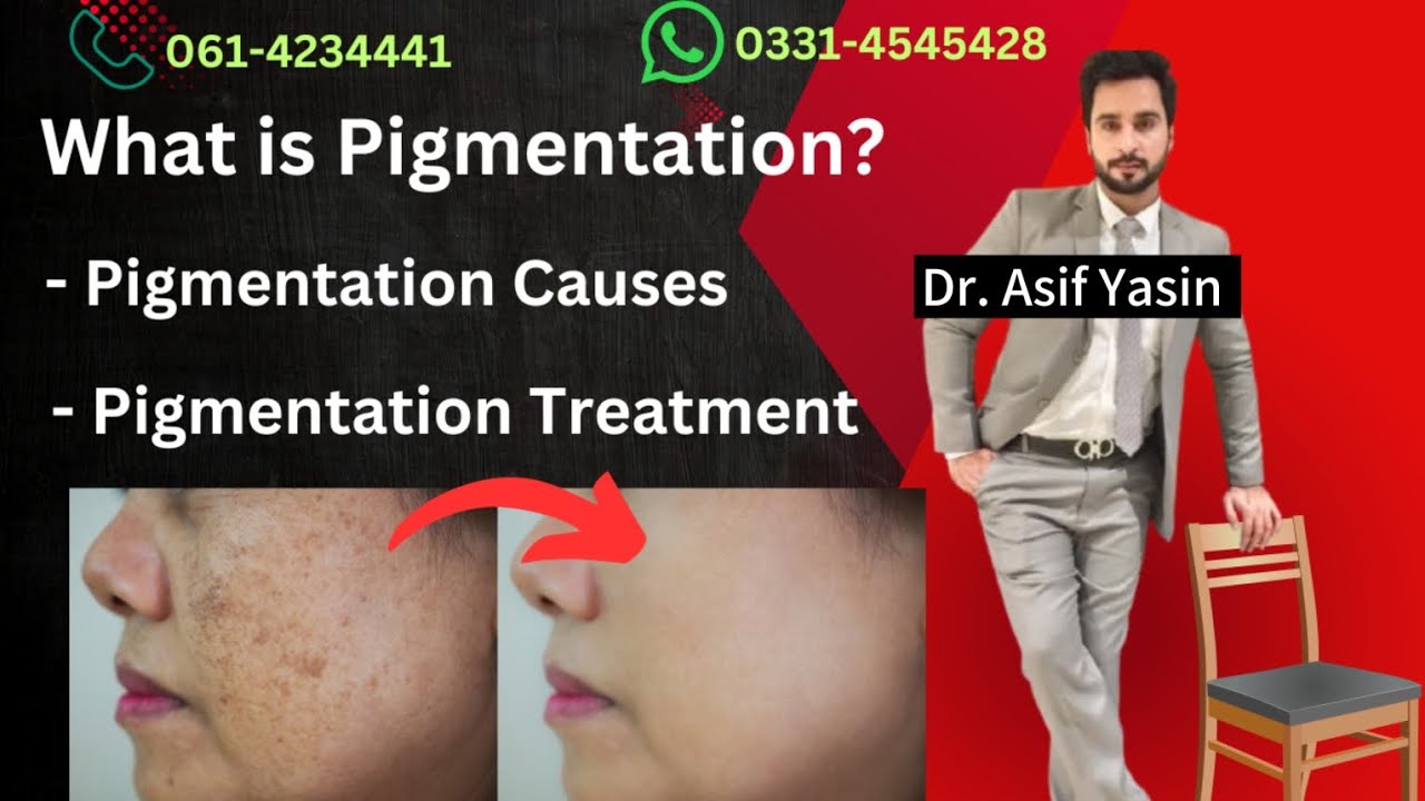 Pigmentation Treatment | Pigmentation Causes | Best Treatment For ...