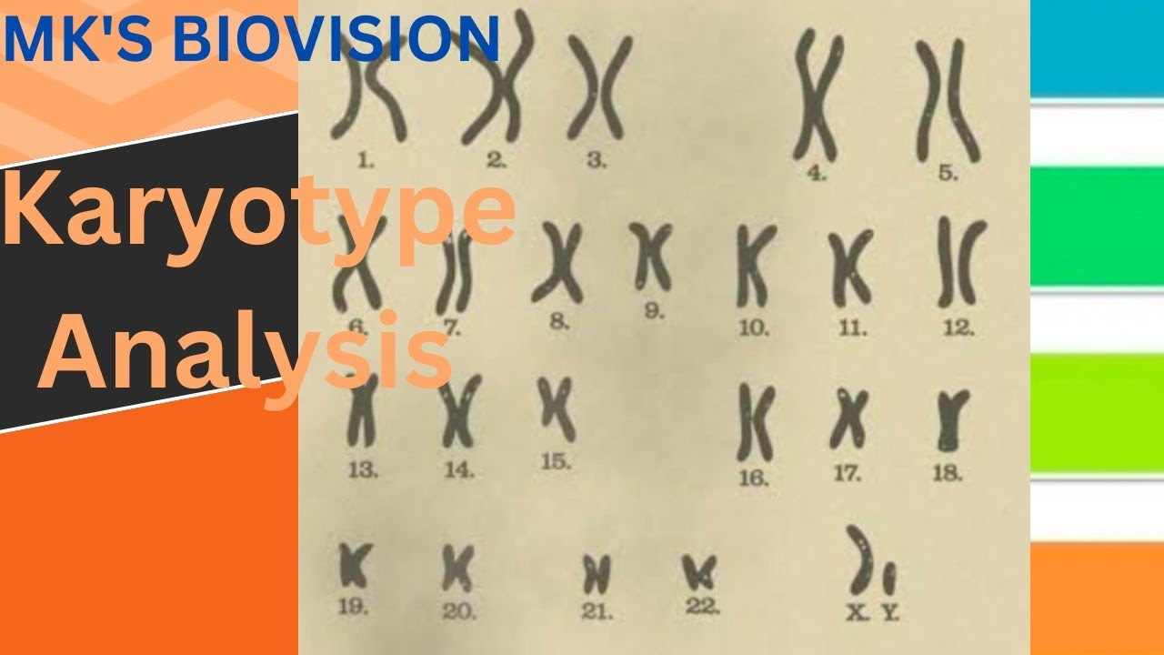 Karyotype Analysis - YouTube
