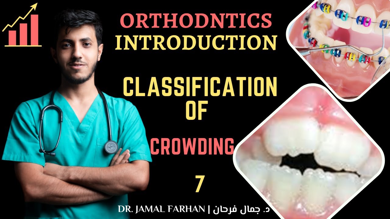 ORTHODONTIC | Lecture 2 | Part 7 | Classification of Crowding | كورس ...