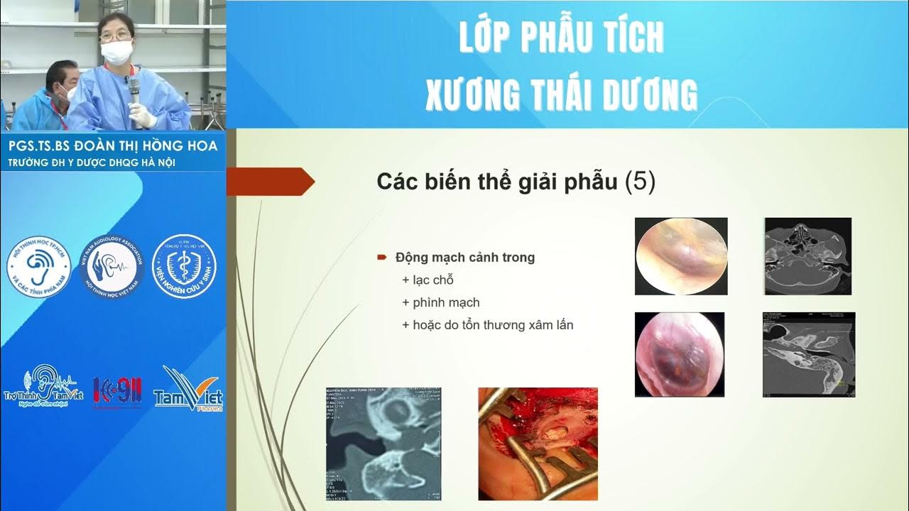 Bài giảng: Phẫu thuật sào bào thượng nhĩ - YouTube