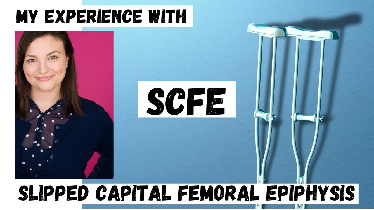 My Experience with SCFE (Slipped Capital Femoral Epiphysis) - YouTube