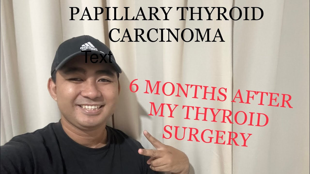 PAPILLARY THYROID CARCINOMA- 6 MONTHS AFTER MY THYROID SURGERY - YouTube