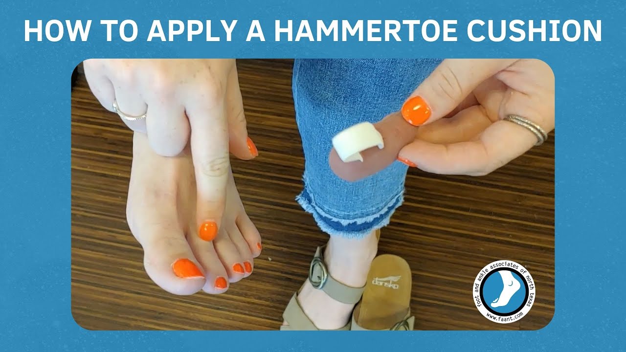 How to Use a Hammertoe Cushion - YouTube