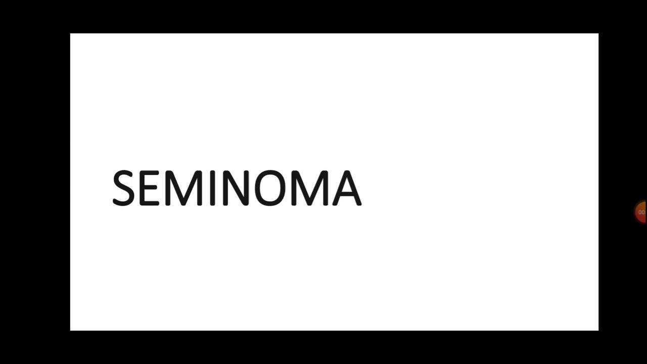 Seminoma, types of seminoma ,treatment, histopathology - YouTube