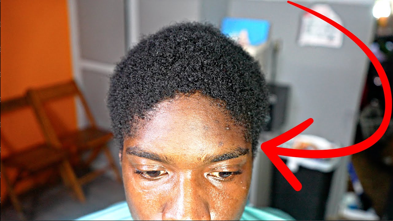 I had to get rid of his OVERGROWN hairline!!! - YouTube