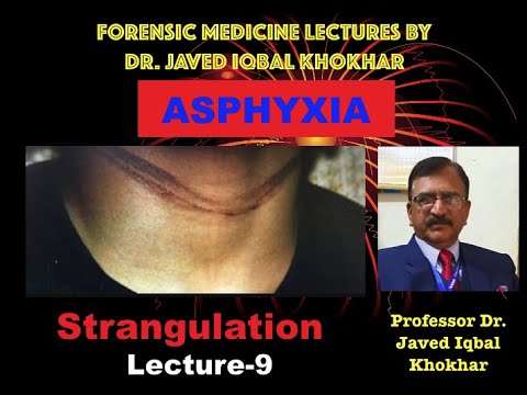 9. ASPHYXIA STRANGULATION MECHANICAL ASPHYXIA BY LIGATURE MUGGING ...