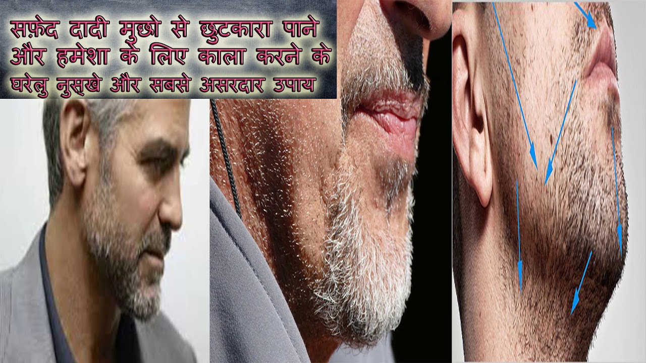 सफ़ेद दादी मुछो से ऐसे पाए छुटकारा/dadi much ke baal kale karne ke upay ...