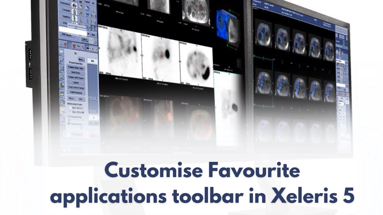 How to Customize the Favorite Applications Toolbar in Xeleris 5? - YouTube