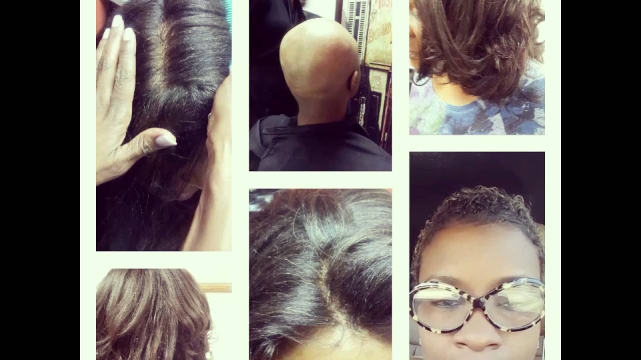 Custom Units for Hair Loss for women and girls - YouTube
