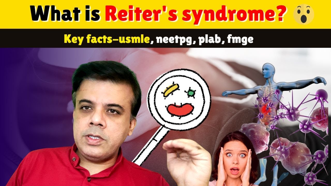 Reiter's Syndrome|What causes Reiter's syndrome?Key facts-usmle, neetpg ...