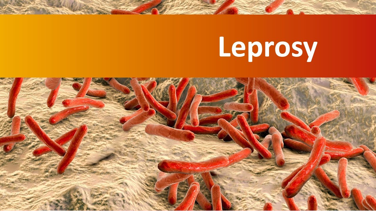 Leprosy Bacteria Structure
