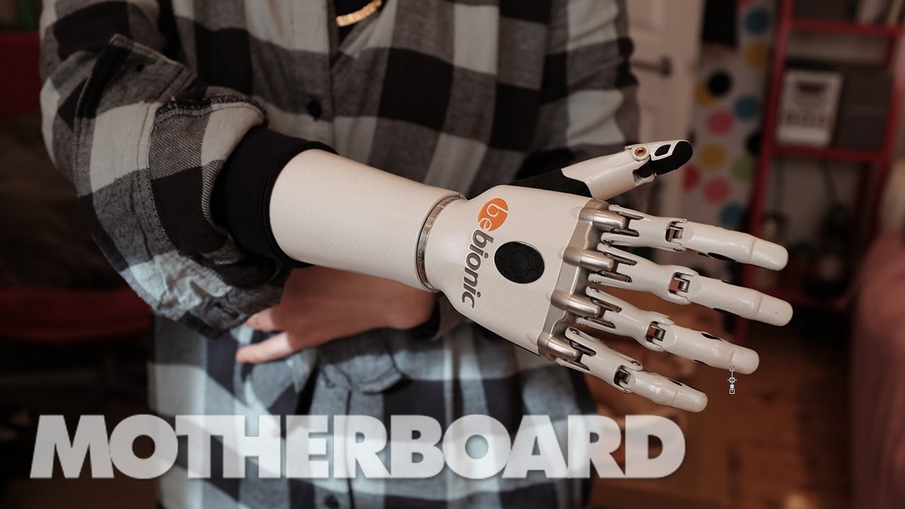 Living With Future Prosthetics - YouTube