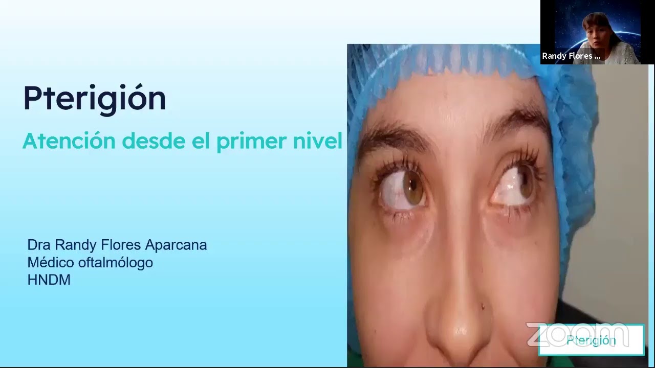 Pterigion en el primer nivel de atención - Oftalmología - YouTube