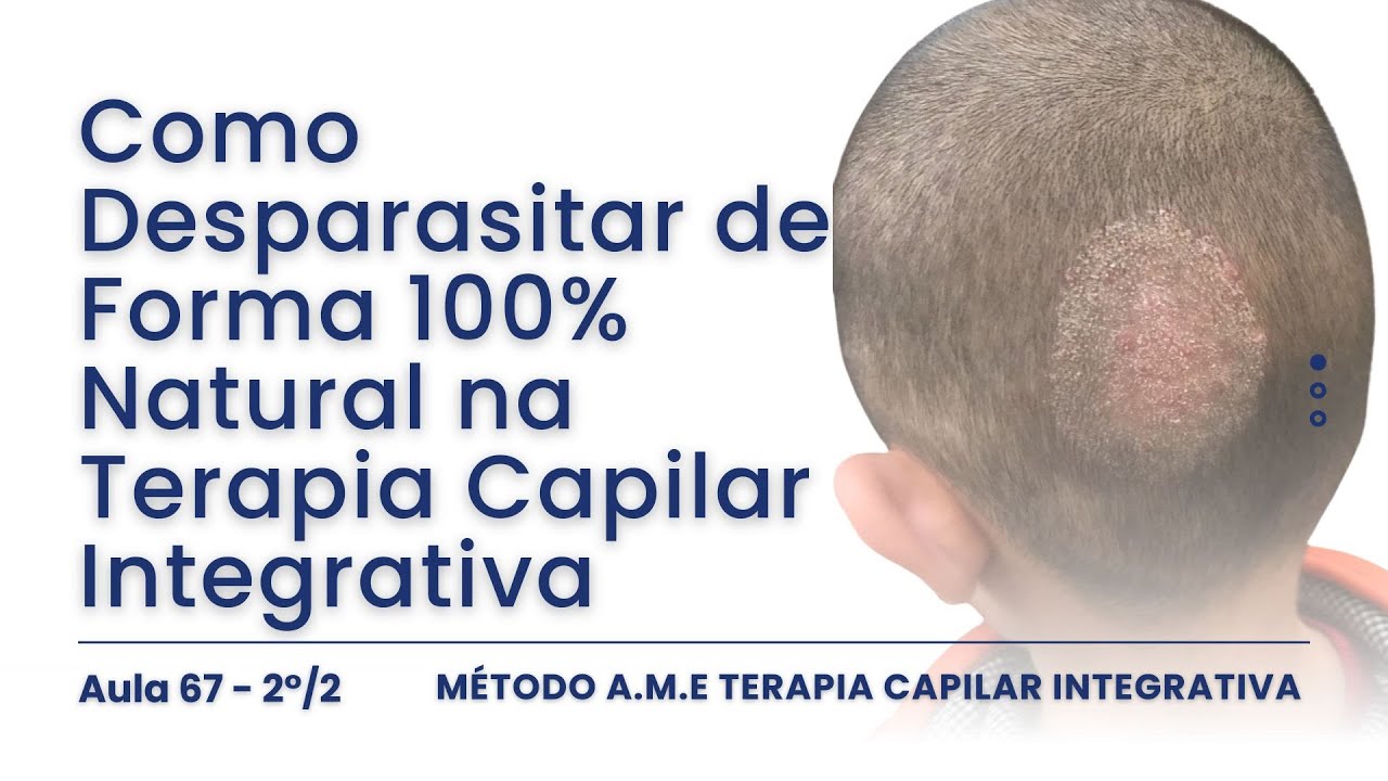 Aula #67 | 2°/2 Como desparasitar de forma 100% natural ...