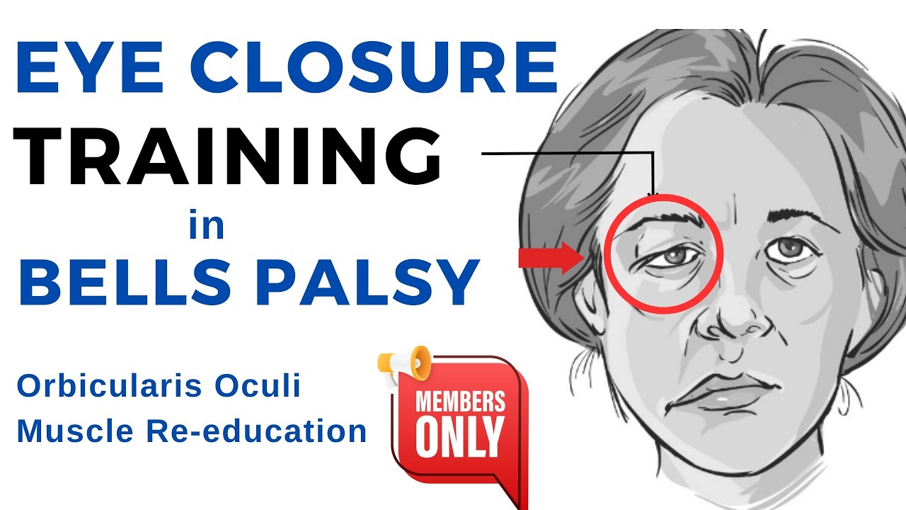 How To Retrain Eye Closure After Bells Palsy Orbicularis Oculi