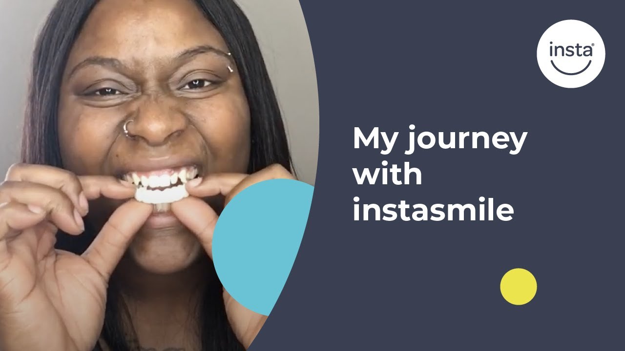 Christina's Instasmile Journey | Clip On Veneers | Instasmile - YouTube