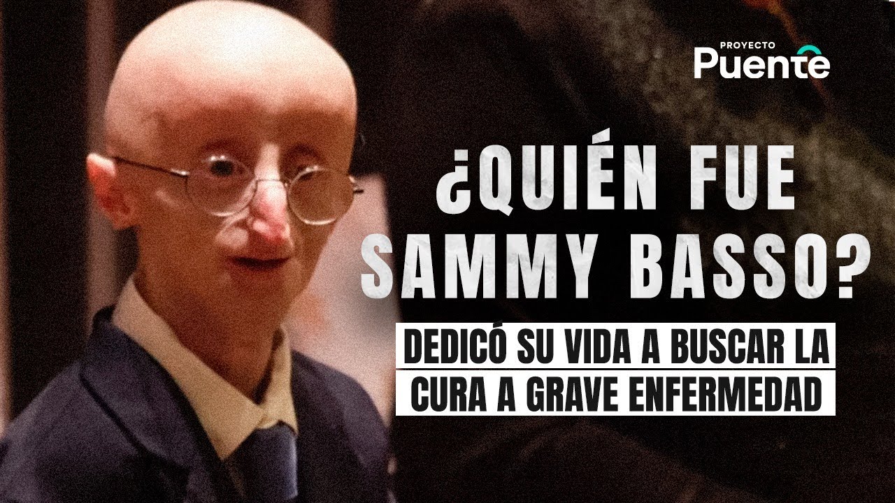 Muere Sammy Basso, el científico que buscaba la CURA para su propia ...