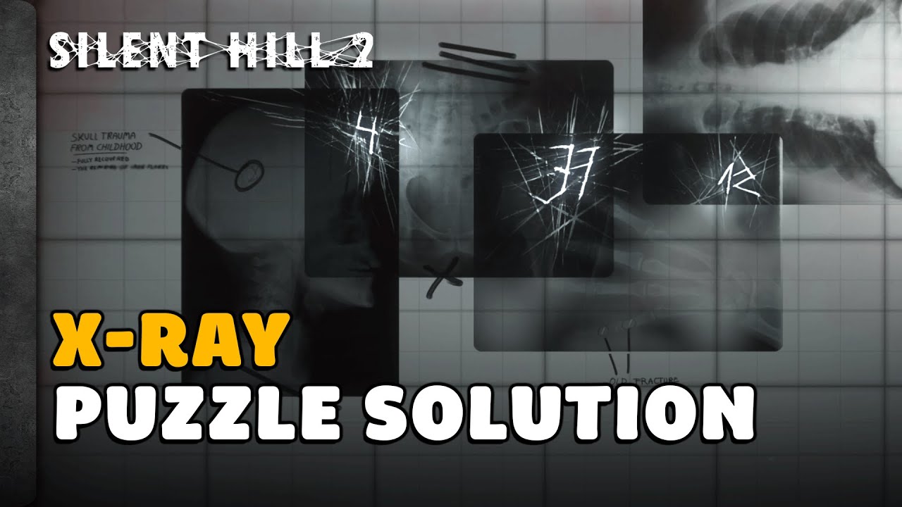 Silent Hill 2 Remake - X-Ray Puzzle Solution (All Difficulty Codes ...