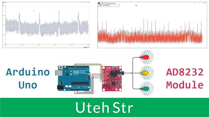 Ad8232 Ecg Module Pinout Interfacing With Arduino 54 Off