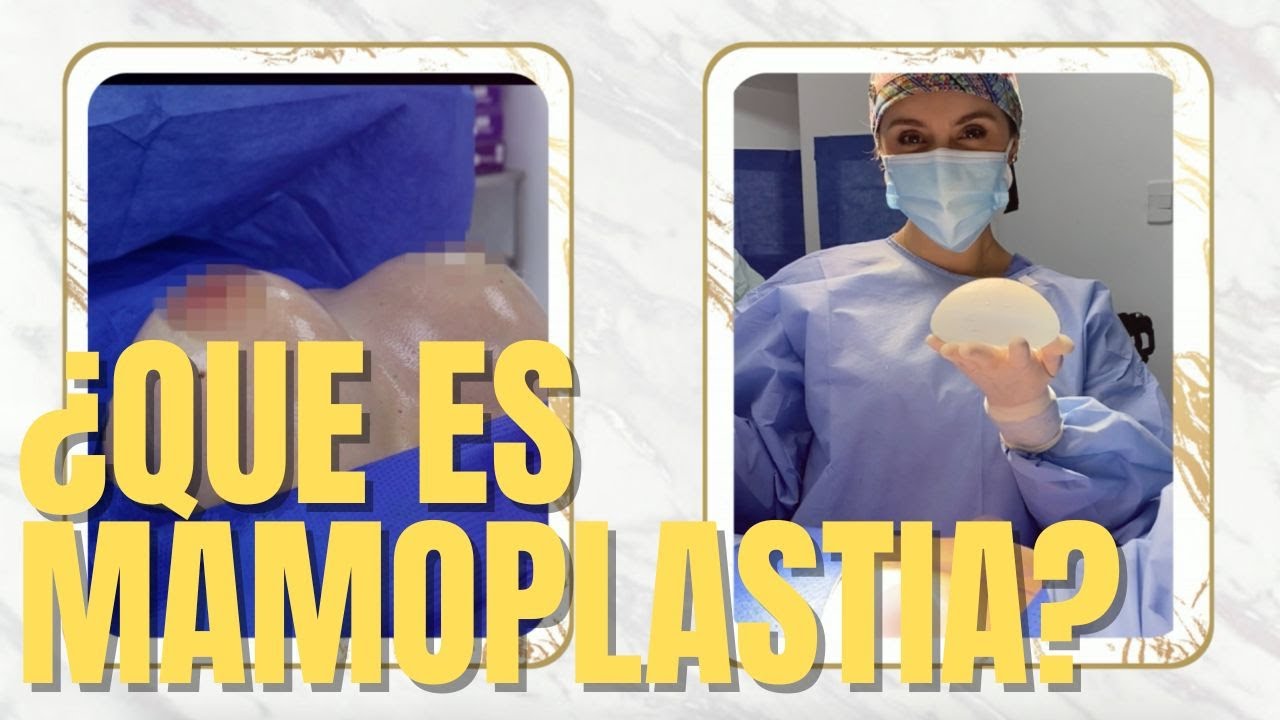 ¿Que es Mamoplastia de aumento ? - YouTube