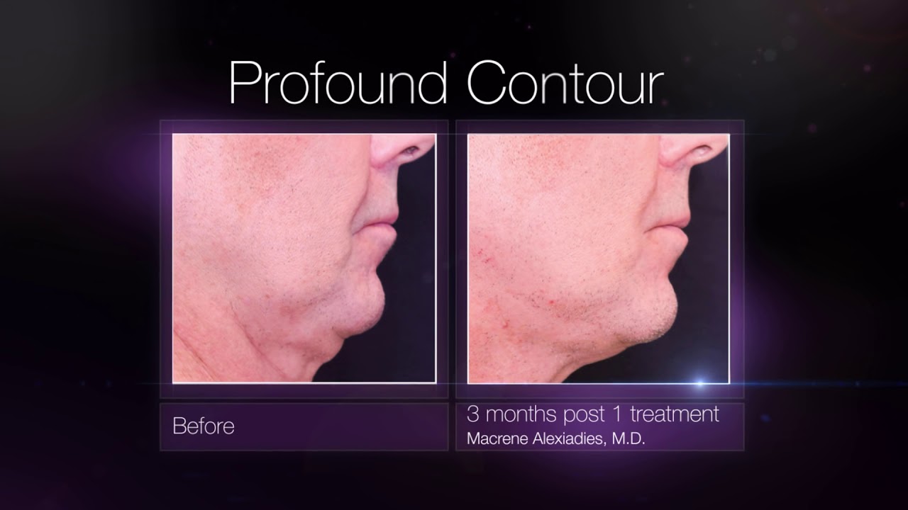 Profound Demonstration - YouTube