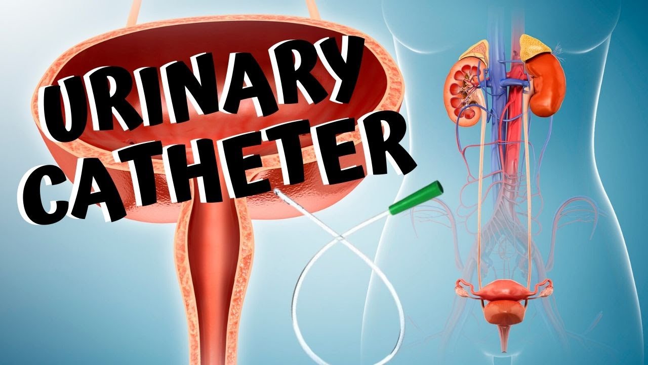 How To Perform Self Catheterization For Urinary Retention At Home YouTube