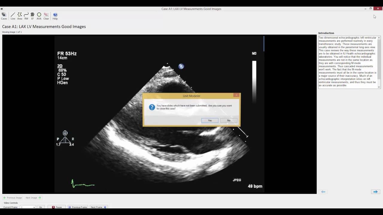 3 Echo Test And Teach Measurement Results YouTube 3-echo-test-and-teach-measurement-results-youtube