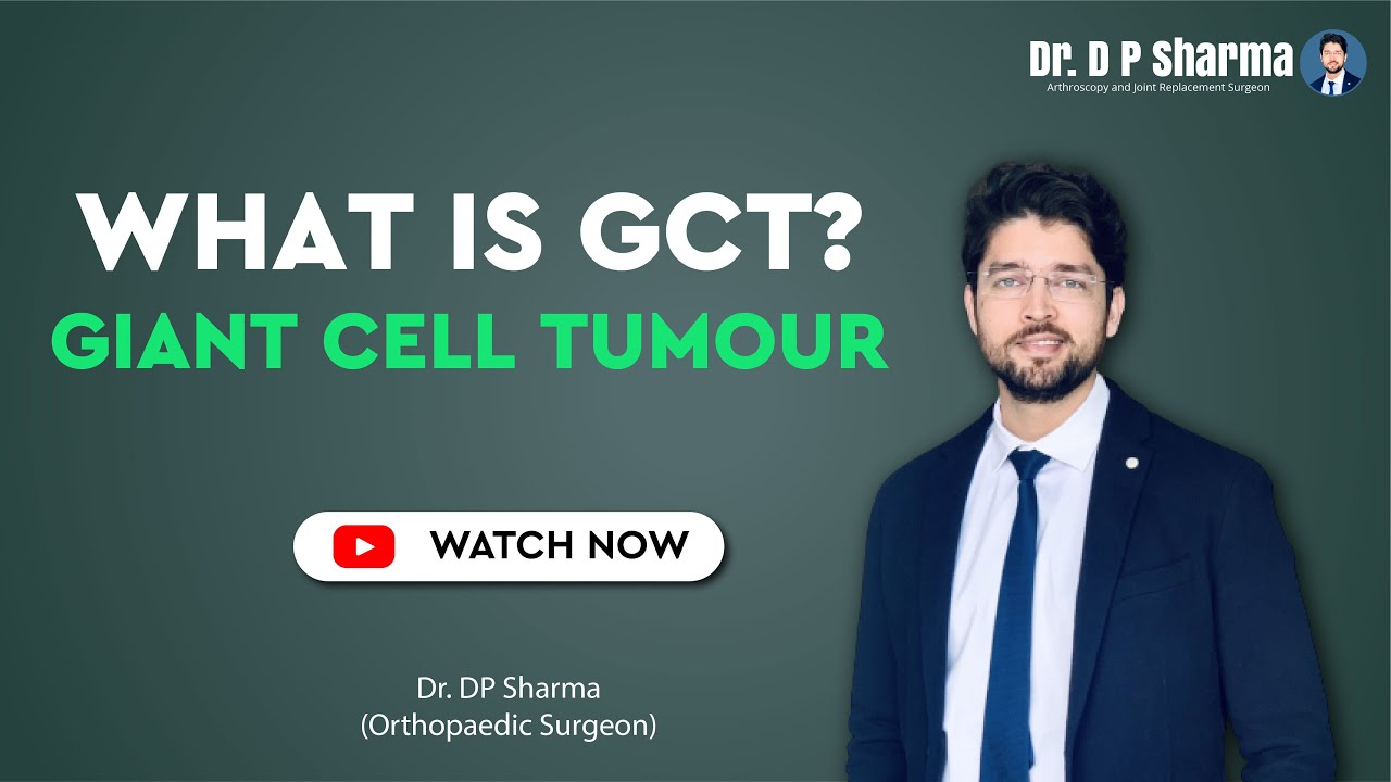 What is GIANT CELL TUMOUR (GCT) ?|| Complete Surgery and Treatment in ...