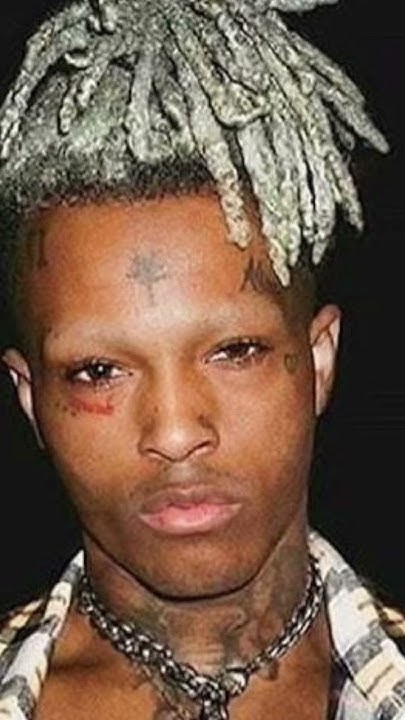 Xxxtentacion Hope Edit Pt7 Youtube