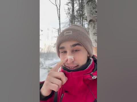Пластырь для носа так и называется, как сказал в видео. - YouTube