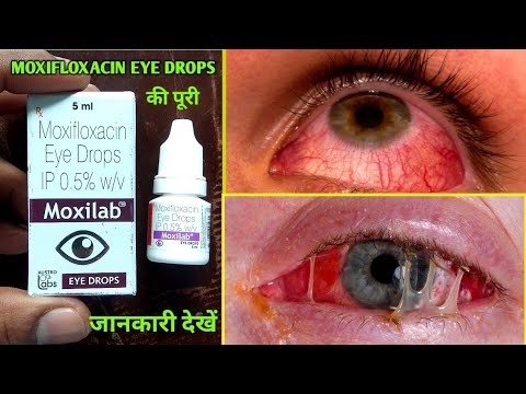 Moxifloxacin Eye Drops Uses Or Side Effects in Hindi - YouTube