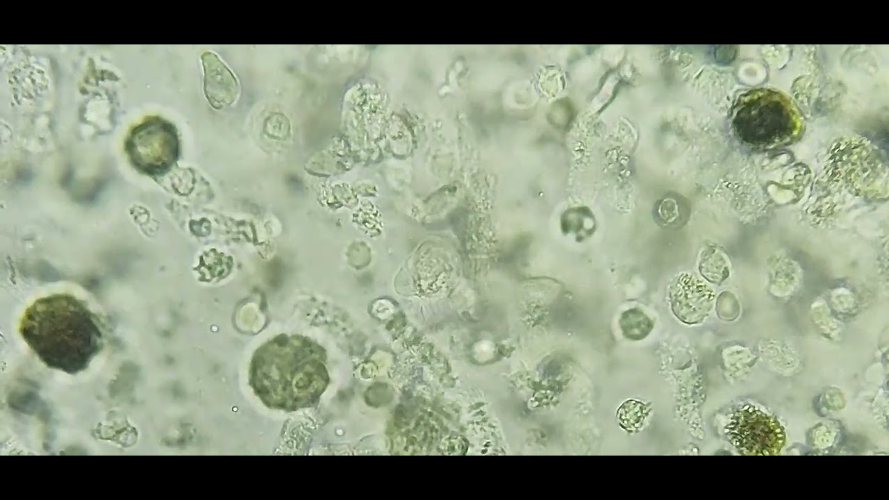 LOPHOMONAS BLATTARUM - YouTube