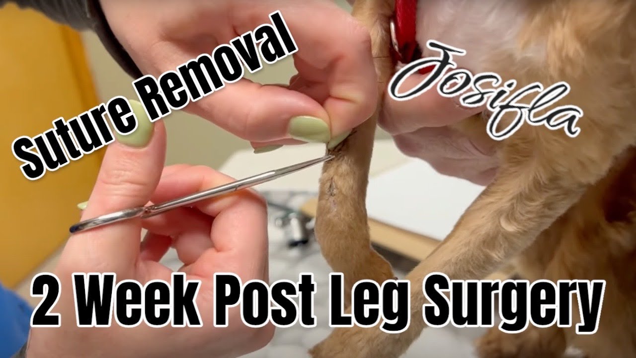2 Weeks Post Leg Surgery | Little Miss Josifia's Suture Remove - YouTube
