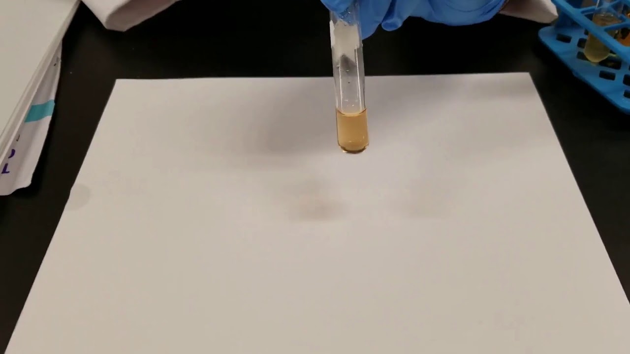 Urea Test - YouTube