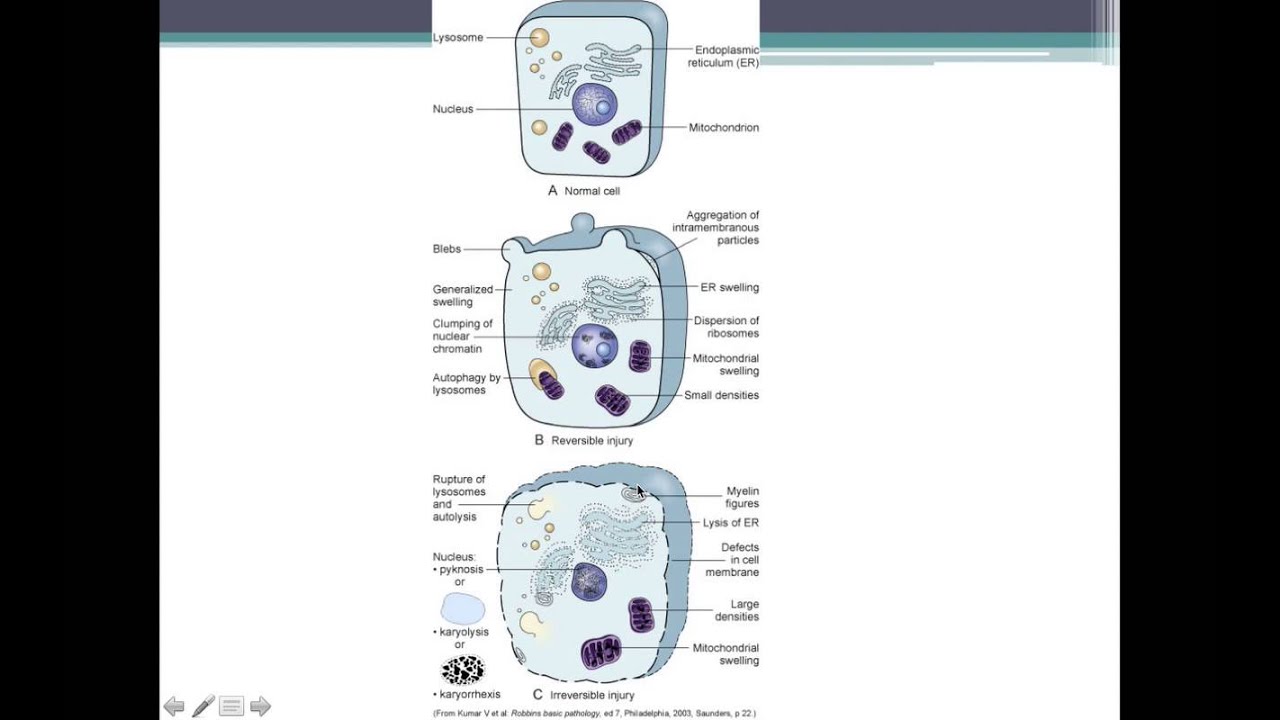 Chapter 4 Cell Injury, Aging and Death BIOL300 - YouTube