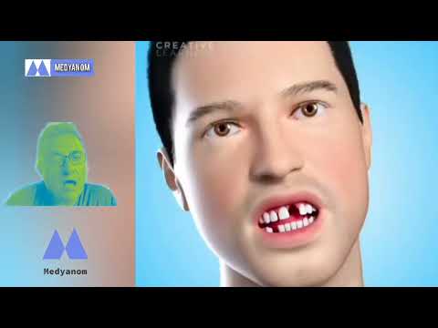 Japon Bilim Adamlarından Mucizevi Buluş - USAG 1